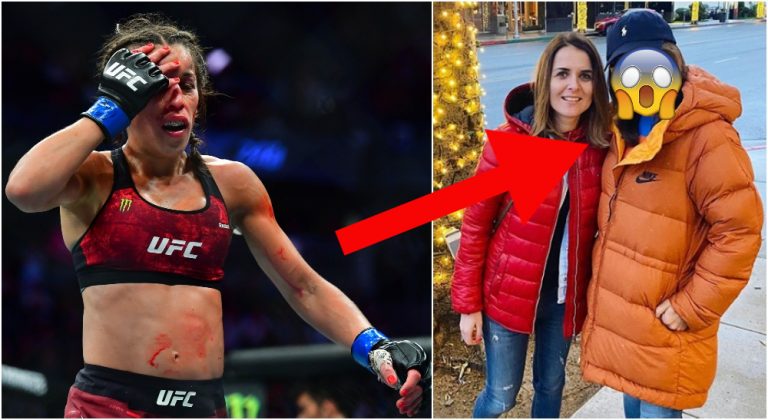Joanna Jedrzejczyk shows off badly bruised face after UFC 248 war with ...